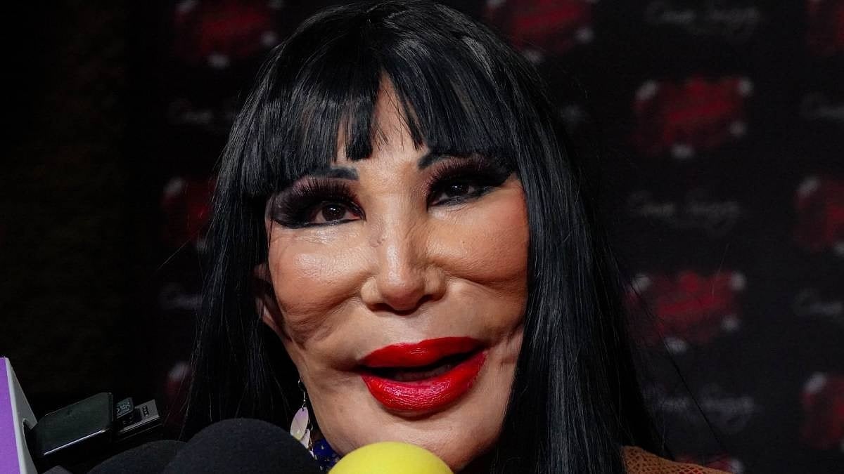 Lyn May'in Estetik Operasyonlar Sonrası Zor Hayatı - Magazin Life